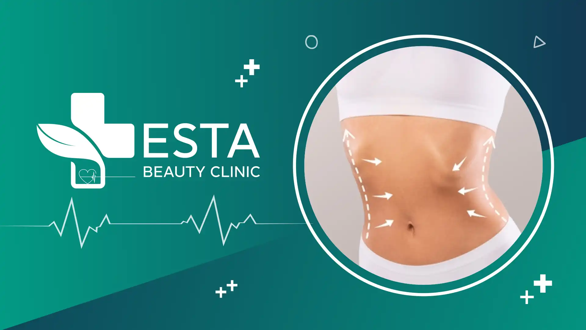 Gastric bypass surgery - Esta Beauty